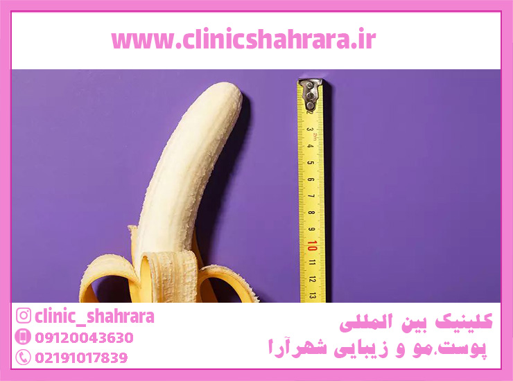 روش بزرگ شدن اندام خصوصی آقایان کلینیک پوست و مو زیبایی شهرآرا